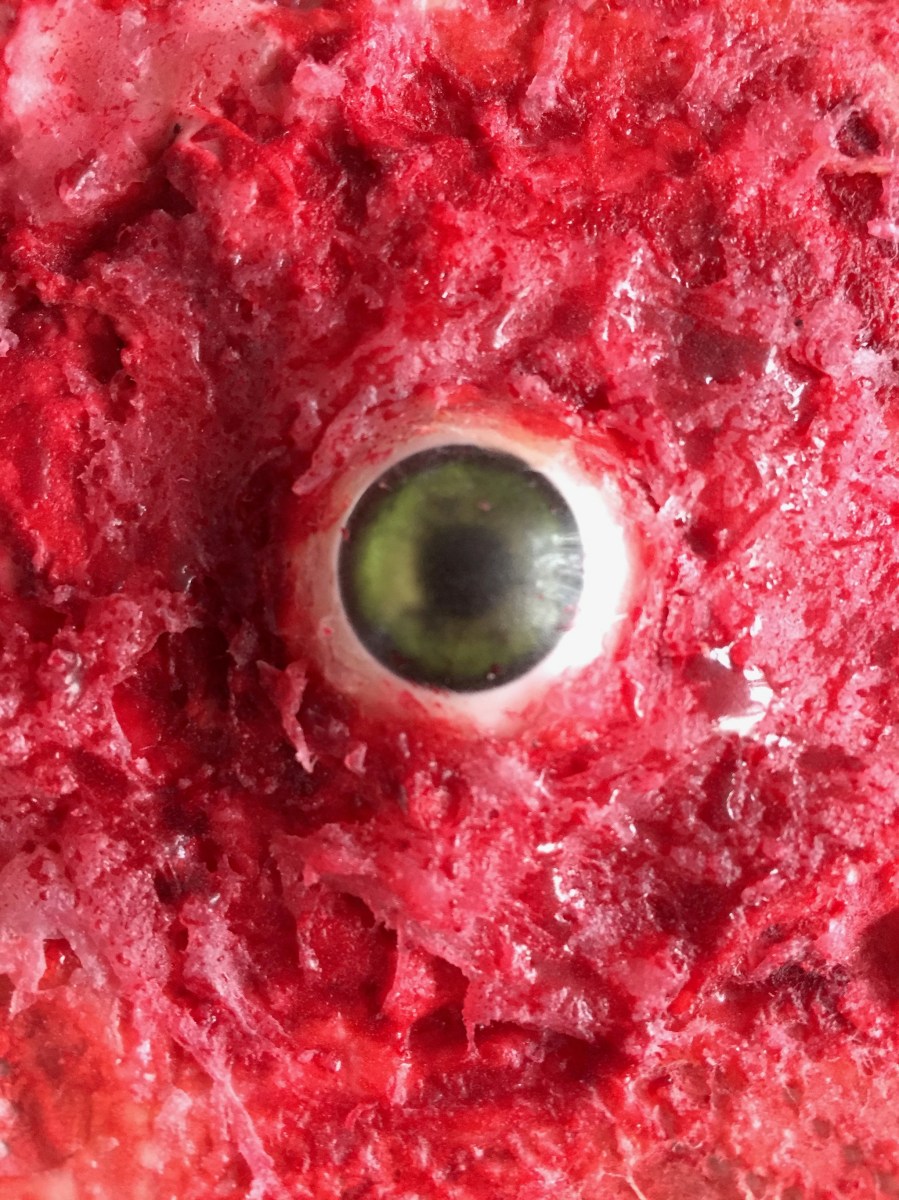 Oogletsels en Chemische verbrandingen. – Lotus Oploo Kring 073